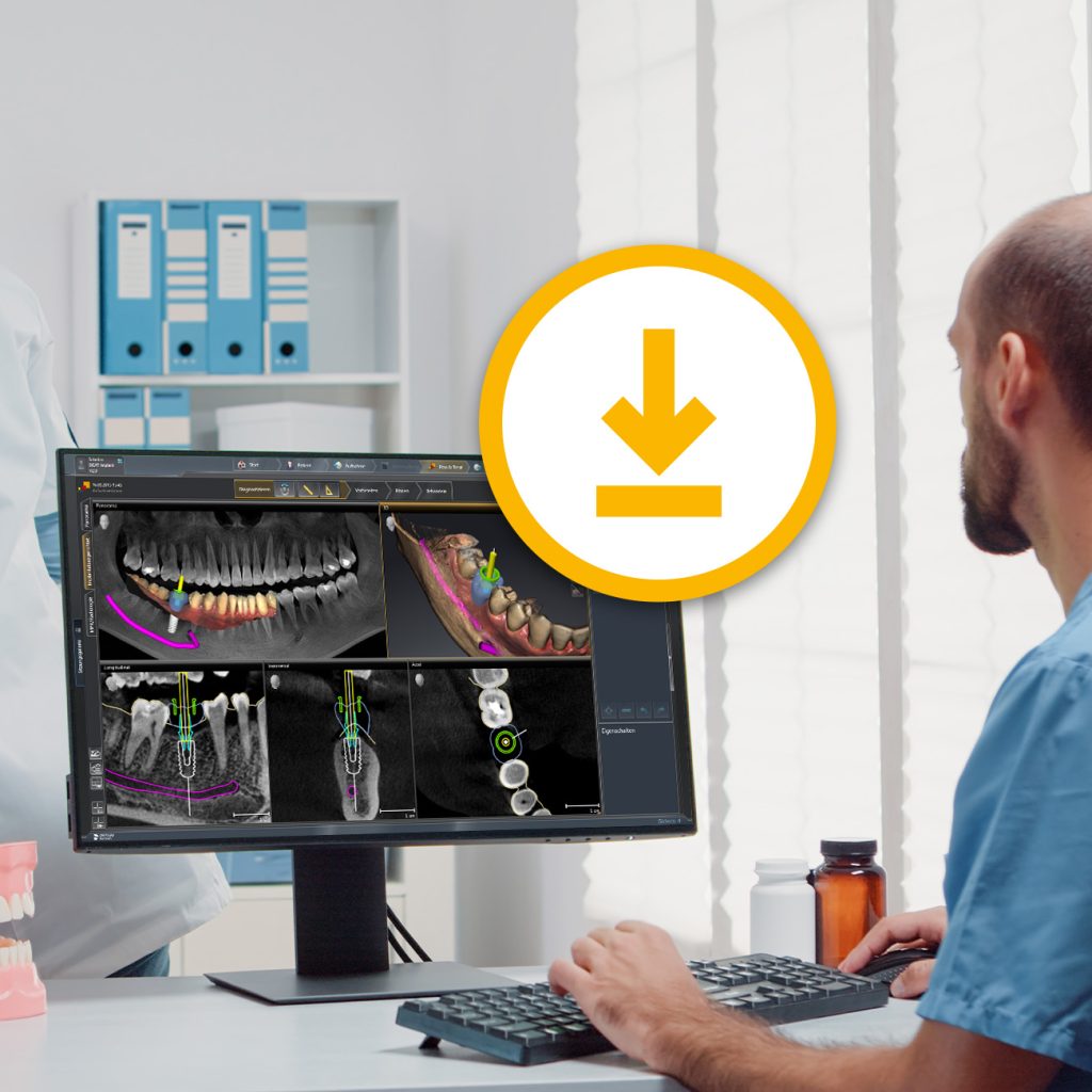 Jetzt verfügbar: Implantatdatenbank-Update für SICAT Implant und Galileos Implant – SICAT