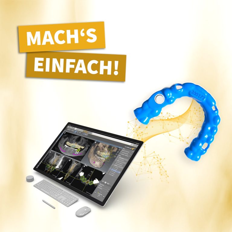 SICAT Implant & Rapid Digitalguide Aktion – SICAT